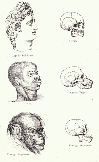 Background of Craniometry